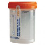 Microalbumin, Random Urine with (w/Creat) – Ascend Reference Manual