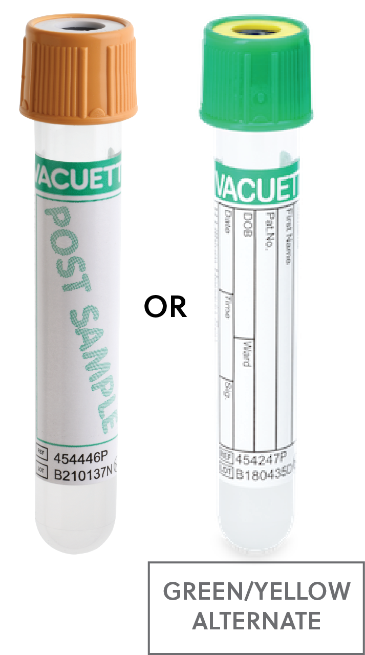 Gold/White Top Tube (Lithium Heparin) – (Post Dialysis Testing ...