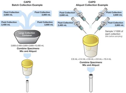 PD (Peritoneal Dialysis) – Ascend Reference Manual